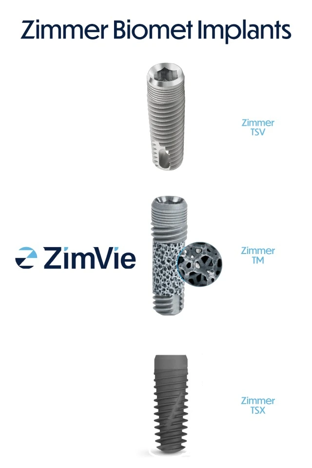 Popular Brands of Dental Implants | Top Choices for 2025